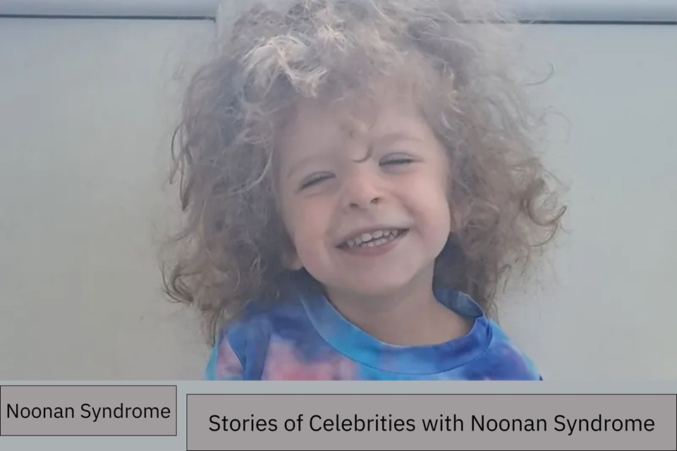 Understanding Noonan Syndrome: Stories Of Celebrities With Noonan ...